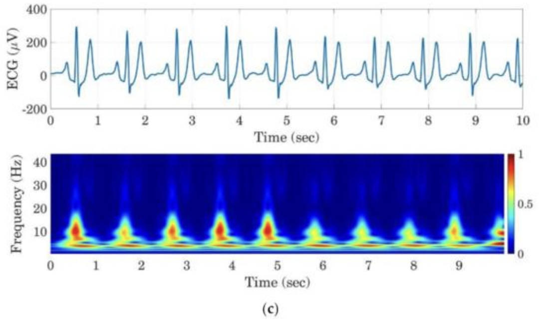 Classification of Electrocardiogram Using Color Images with Pixel Method by Deep CNN. - Daffodil ...